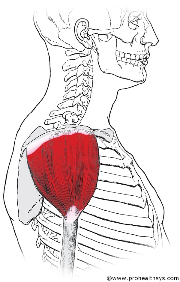 Shoulder & Arm - Hithera